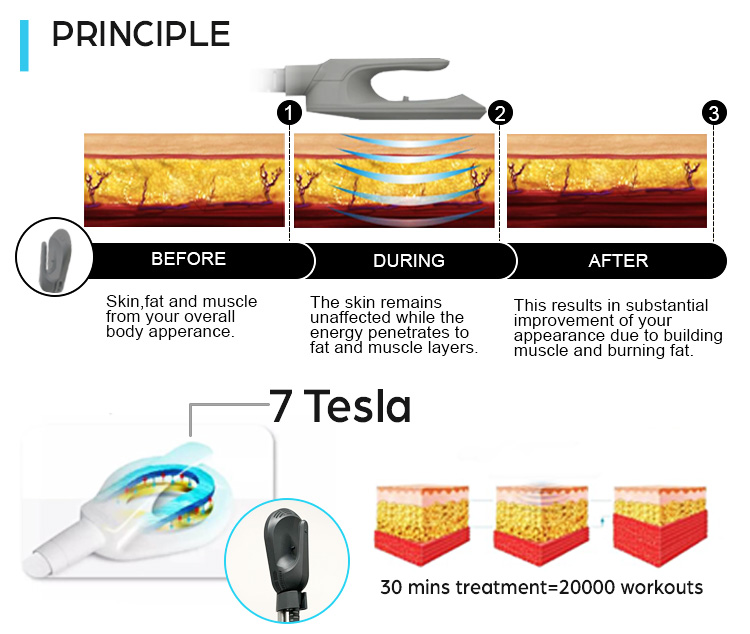 Portable hiemt muscle building and fat burning machine EMS9 - Buy ...